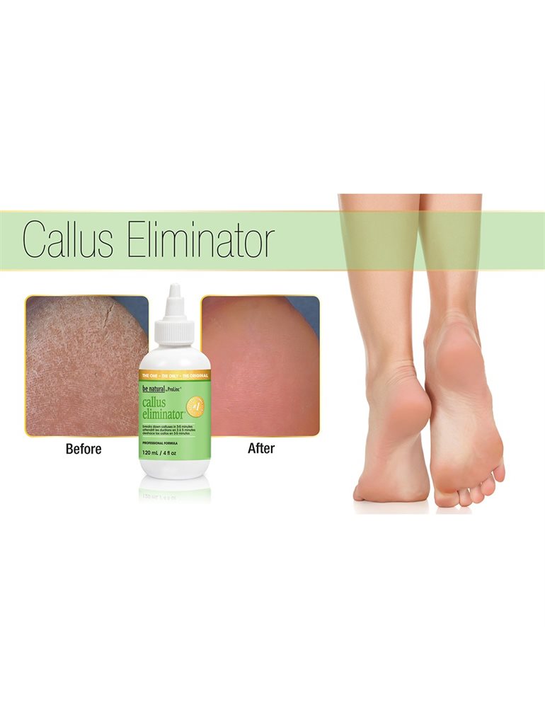 Éliminateur de callosités 4oz